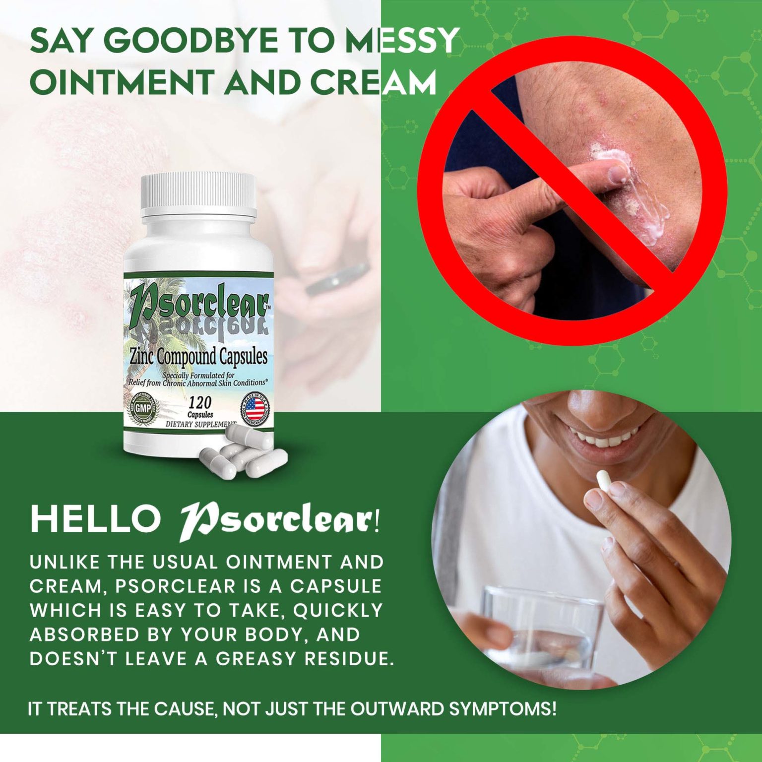 Buy Psorclear Now! - Finally an effective Psoriasis & Eczema Treatment!
