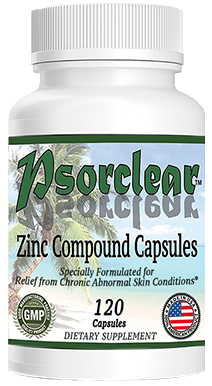 Psorclear is Proven Effective Treatment for Psoriasis and Eczema